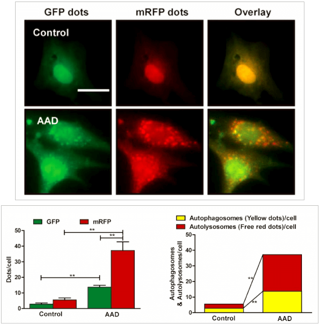 Adenovirus-LC3 production service for Autophagy Flux Detection | GeneMedi